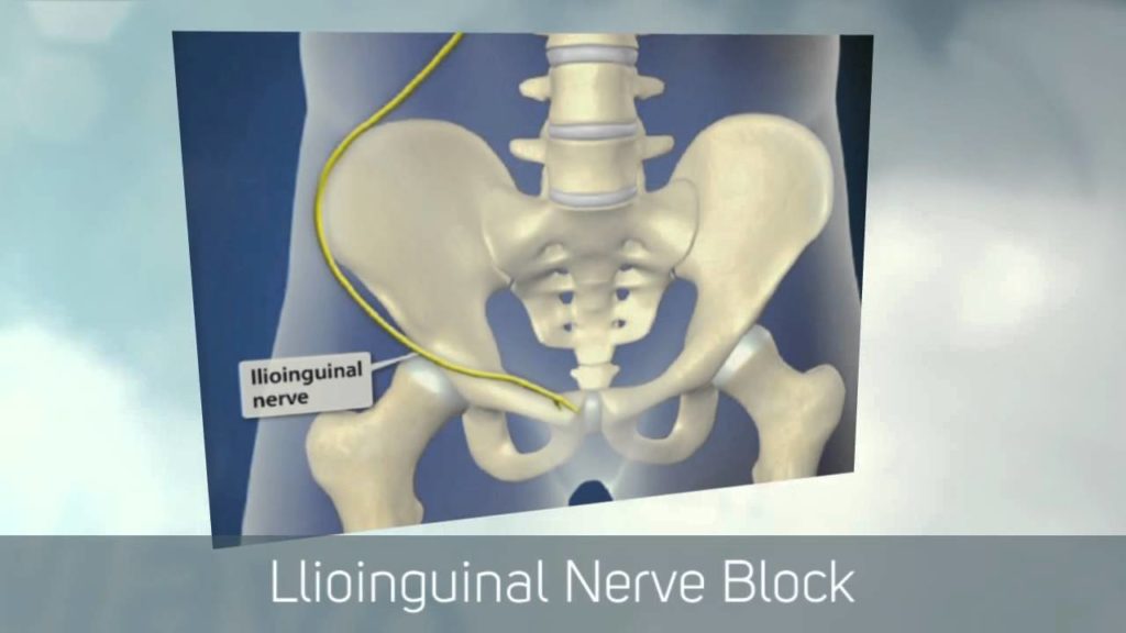 Prestige Pain Centers - Nerve Blocks Occipital to Ilioinguinal